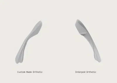 Comparison of Interpod semi-rigid prefabricated foot orthoses and Cust